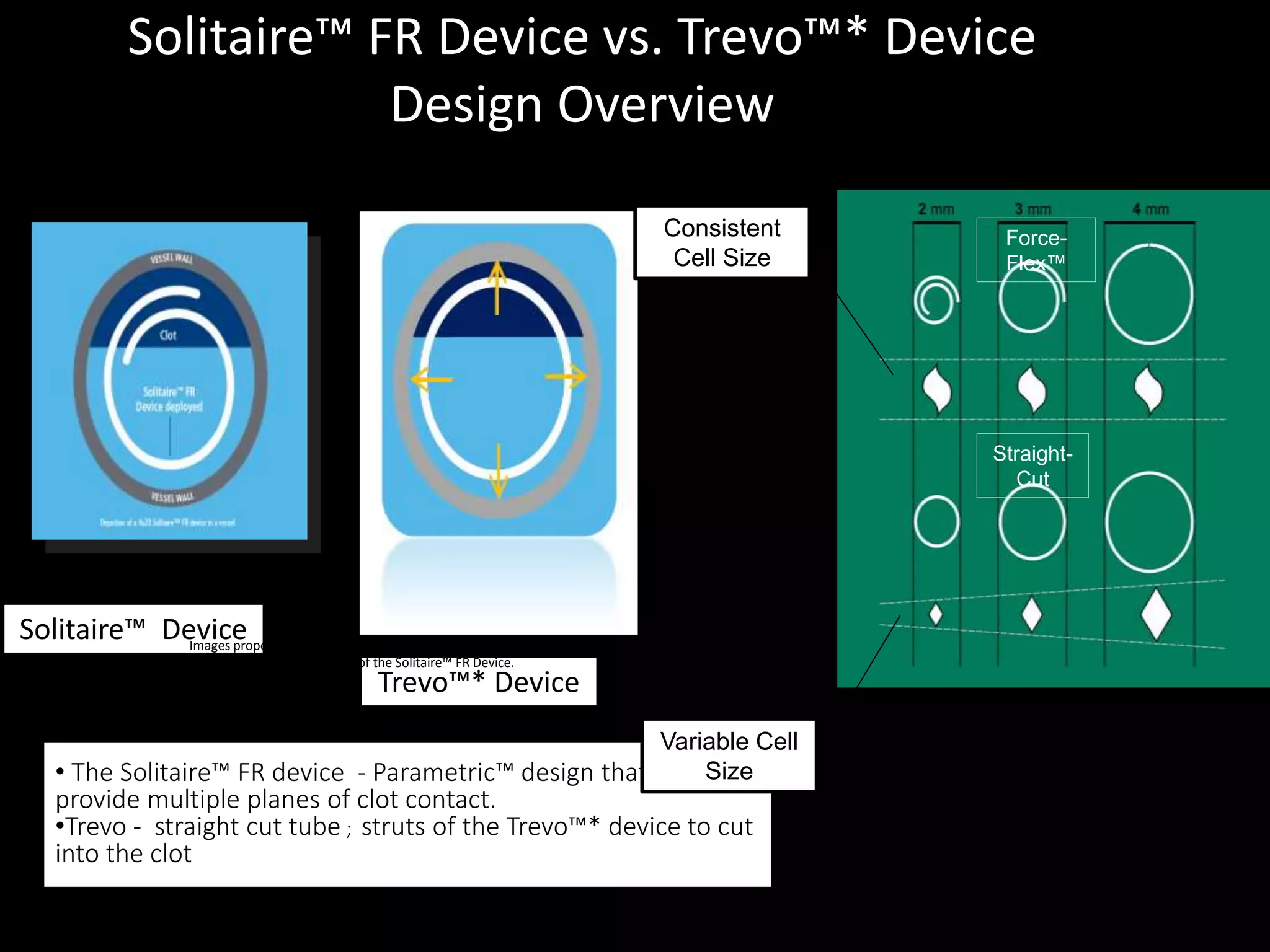 Mechanical thrombectomy with stent retriever | PPTX