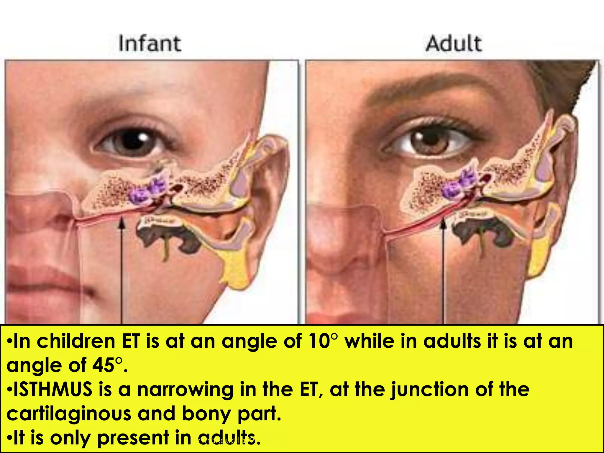 Acute suppurative otitis media | PPTX | Ear, Nose and Throat Conditions ...