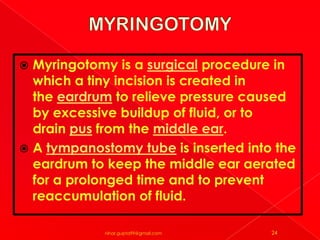 Acute suppurative otitis media | PPTX