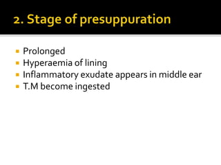 Acute suppurative otitis media | PPTX