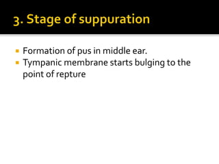 Acute suppurative otitis media | PPTX