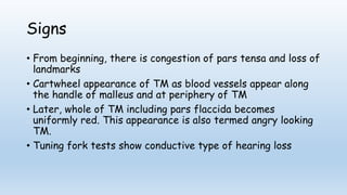 Acute suppurative otitis media | PPTX
