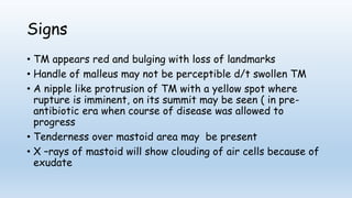 Acute suppurative otitis media | PPTX