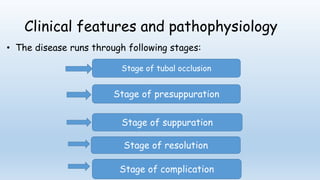 Acute suppurative otitis media | PPTX