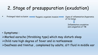 Acute suppurative otitis media | PPTX