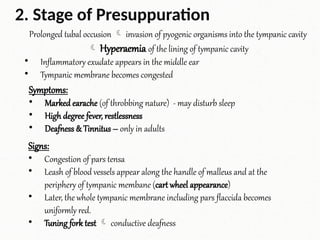 Acute Suppurative Otitis Media : Infection of Middle Ear | PPTX