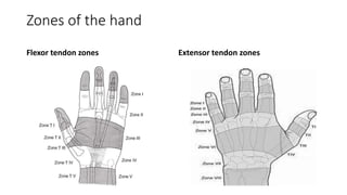 Acute Tendon injury of the Hand and its Repair.pptx | Death, Injury, or ...