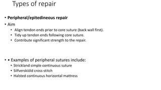 Acute Tendon injury of the Hand and its Repair.pptx