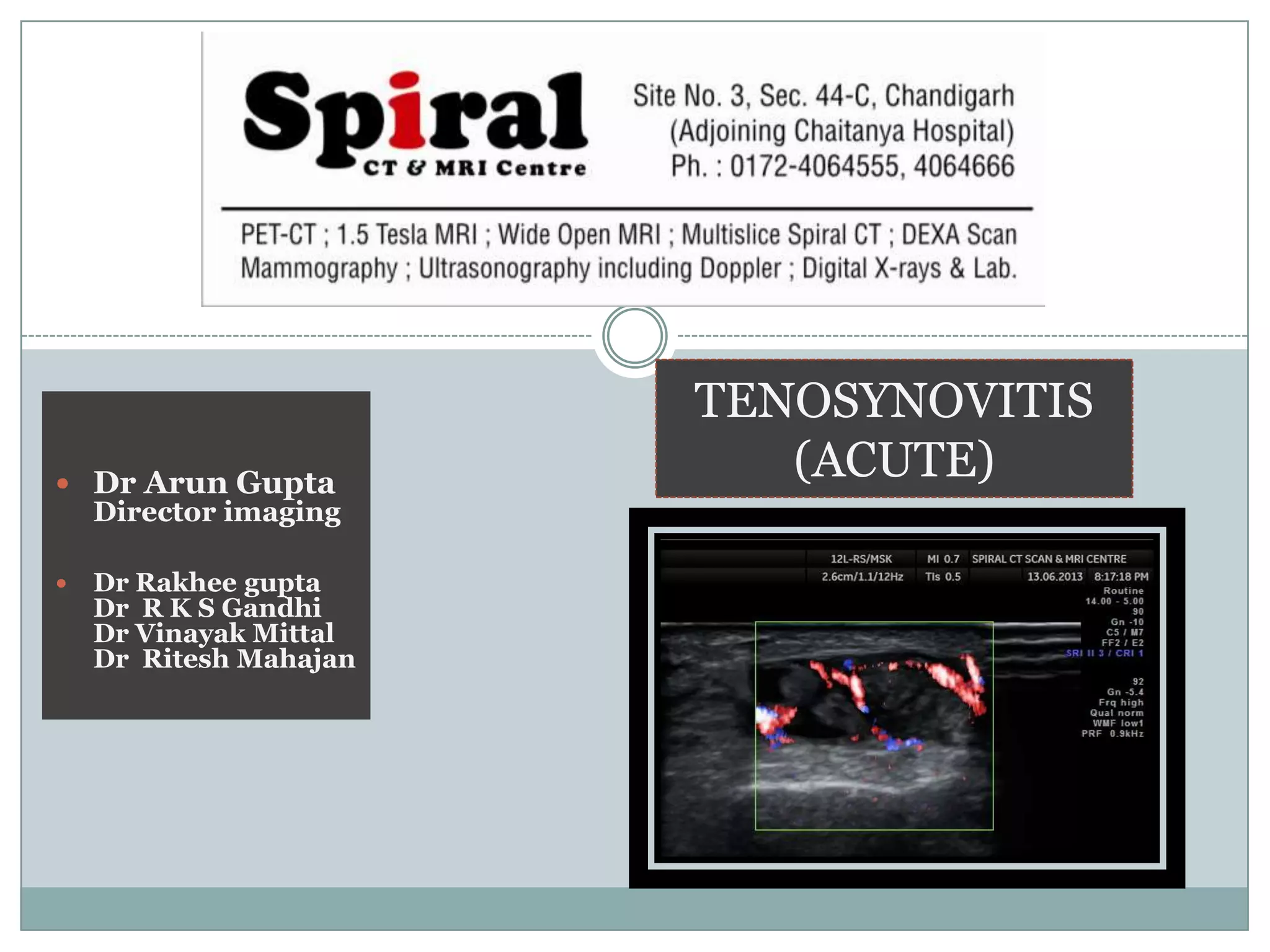 Acute tenosynovitis | PPTX