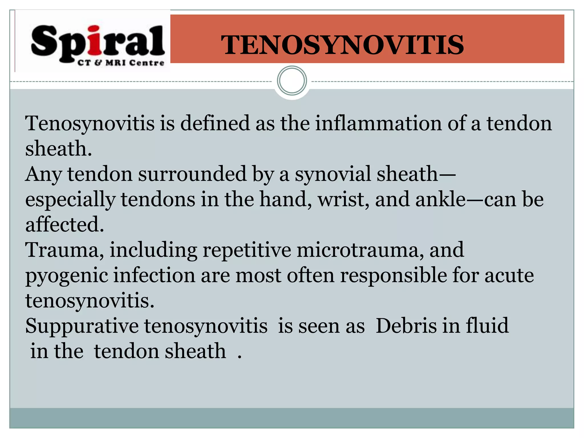 Acute tenosynovitis | PPTX