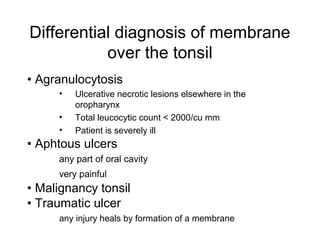 Acute tonsillitis | PPT