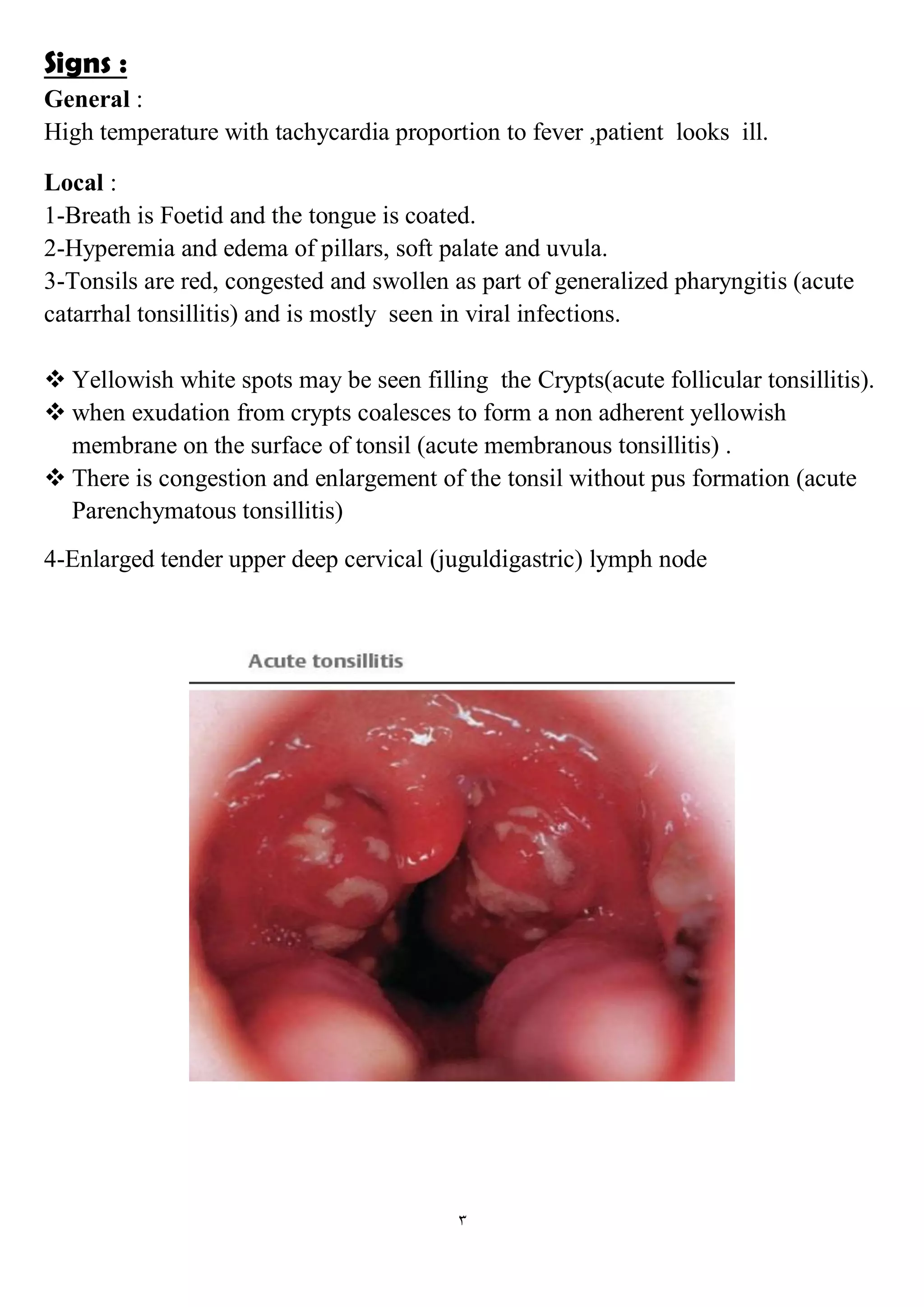 Acute tonsillitis | PDF | Ear, Nose and Throat Conditions | Diseases and Conditions