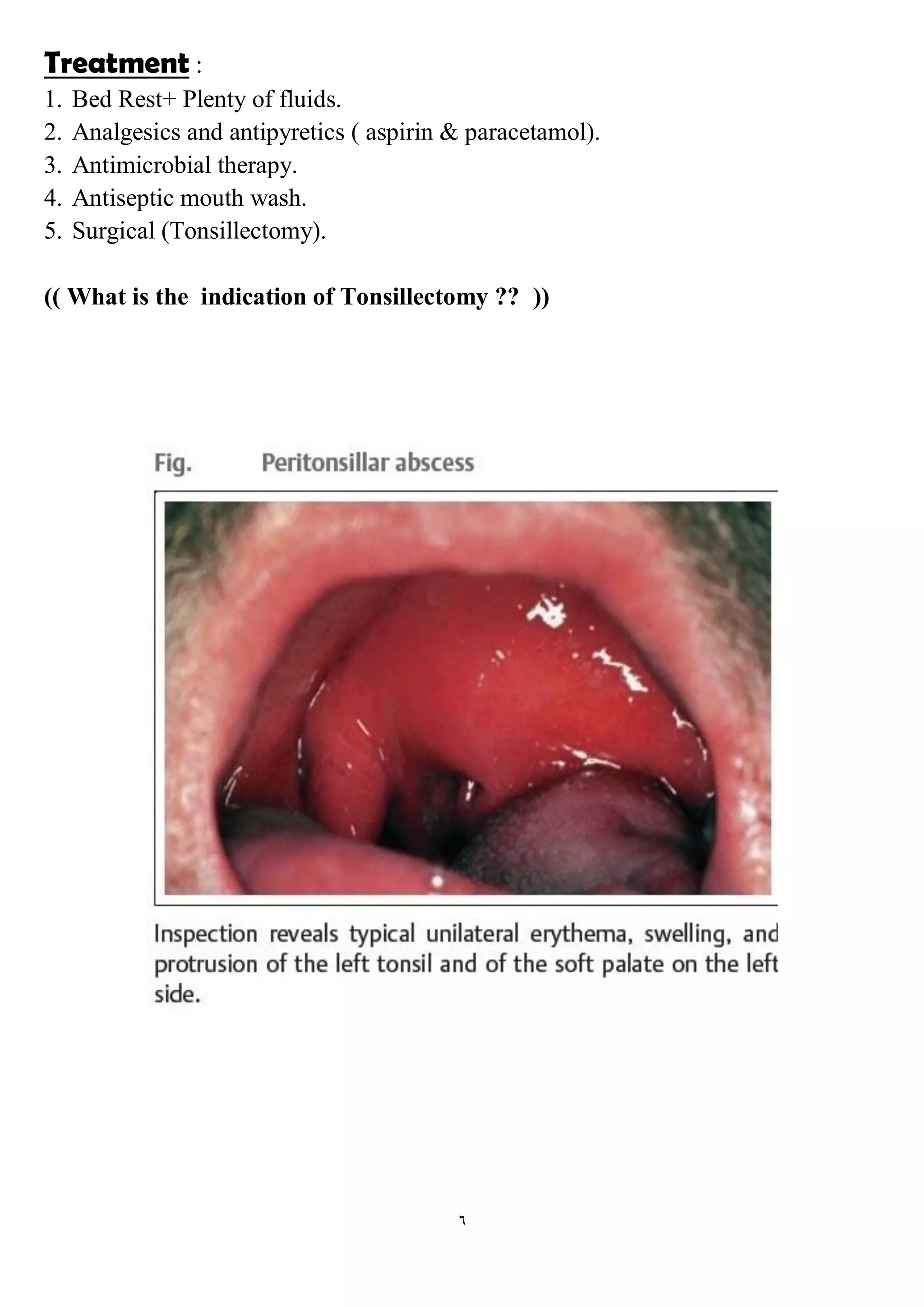 Acute tonsillitis | PDF