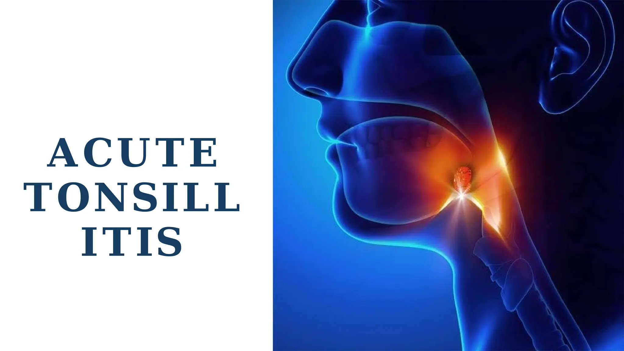 ACUTE TONSILLITIS 35.pptx ACUTE TONSILLITIS 35.pptx