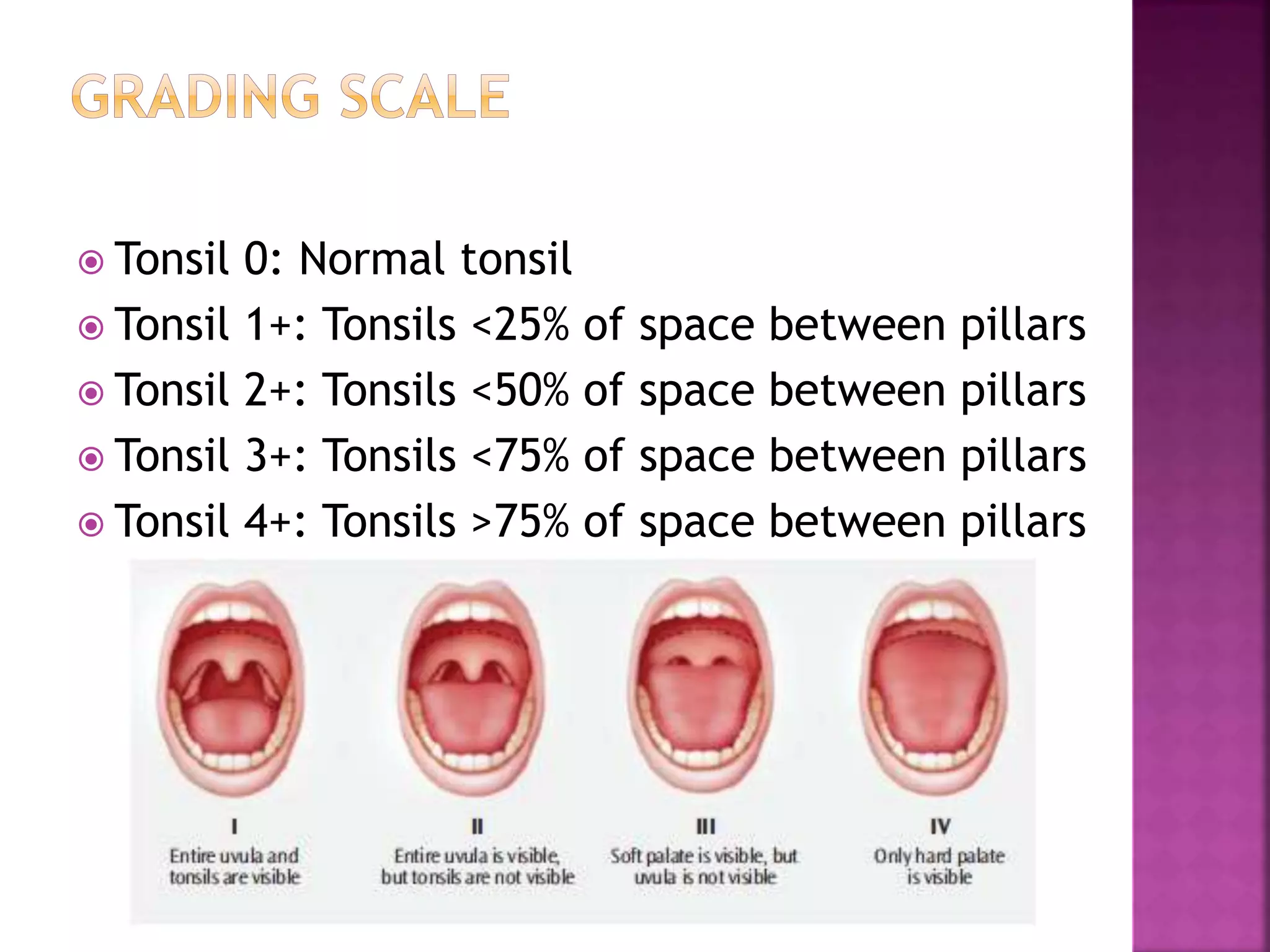 Acute tonsillopharyngitis | PPTX