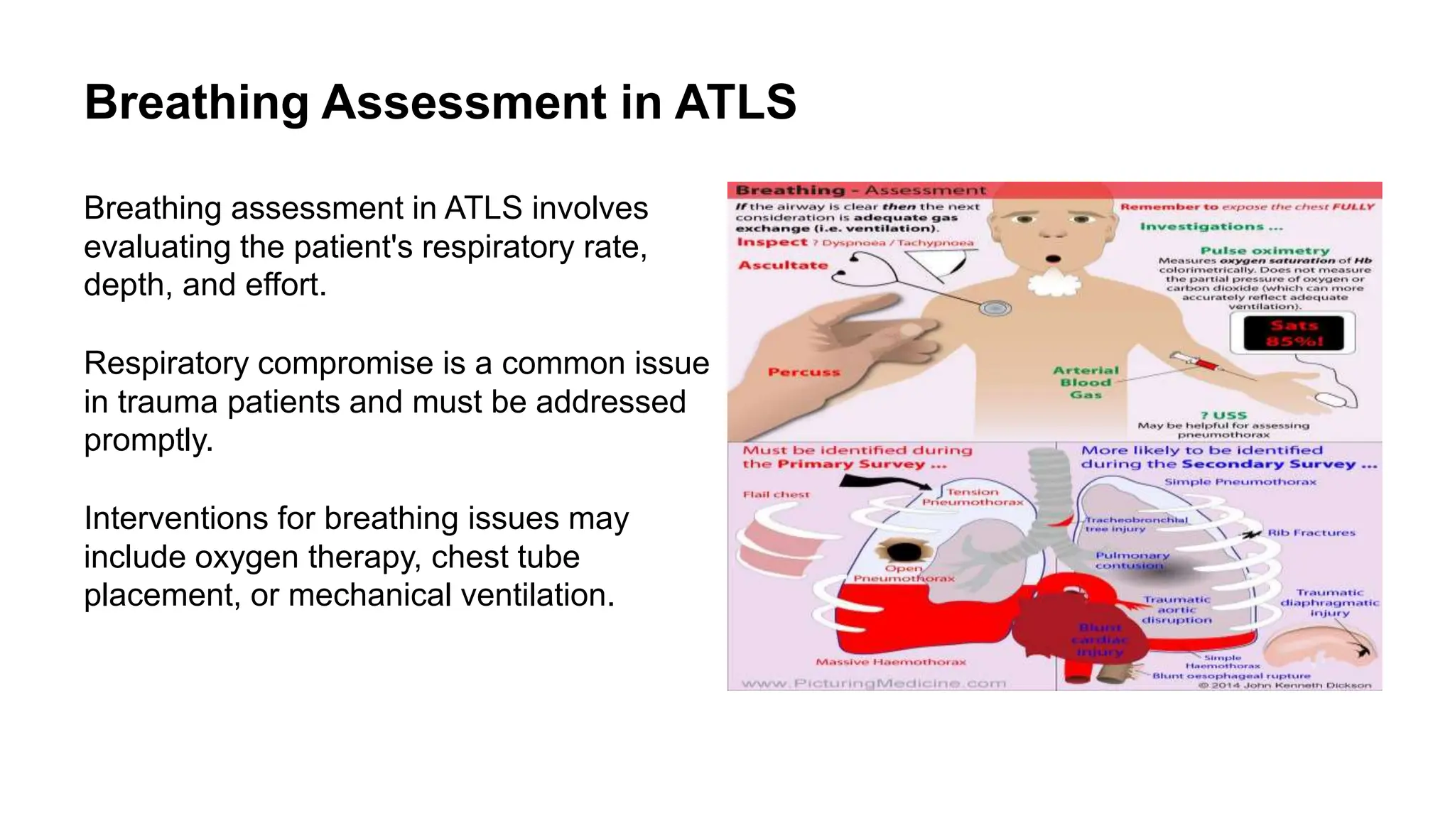 ACUTE TRAUMA LIFE SUPPORT IN MEDICINE PPT | PPTX