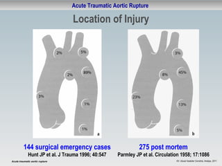 Acute traumatic aortic rupture | PPT