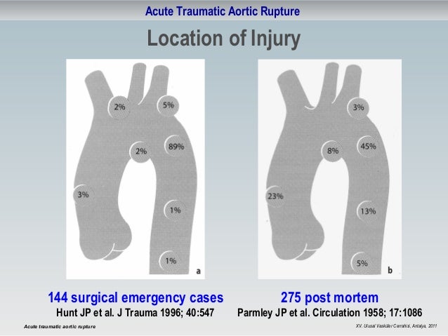 Acute traumatic aortic rupture