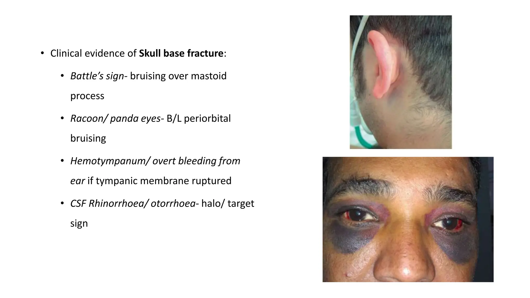ACUTE TRAUMATIC BRAIN INJURY - PRESENTATION AND MANAGEMENT | PPTX ...
