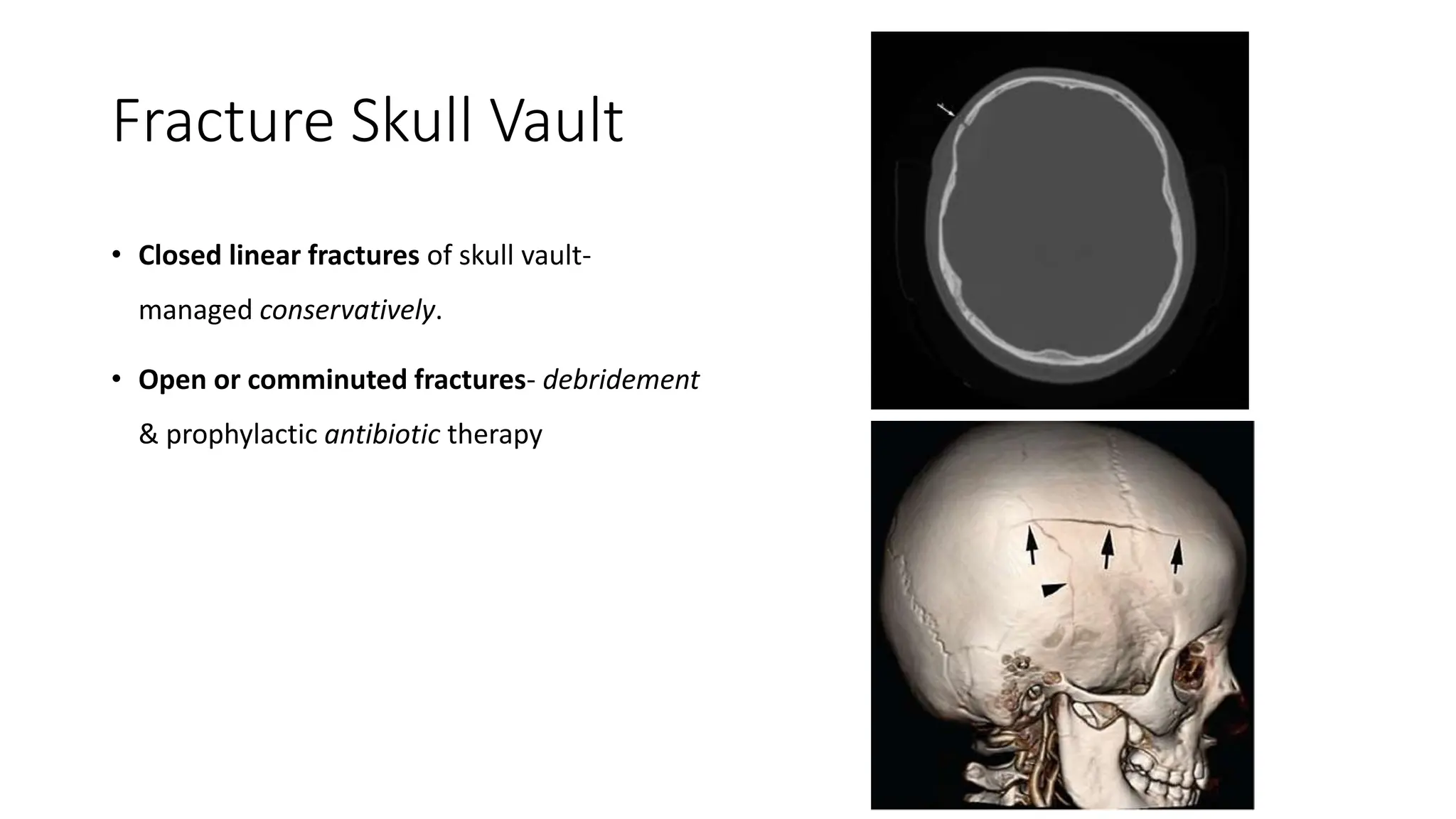 ACUTE TRAUMATIC BRAIN INJURY - PRESENTATION AND MANAGEMENT | PPTX ...