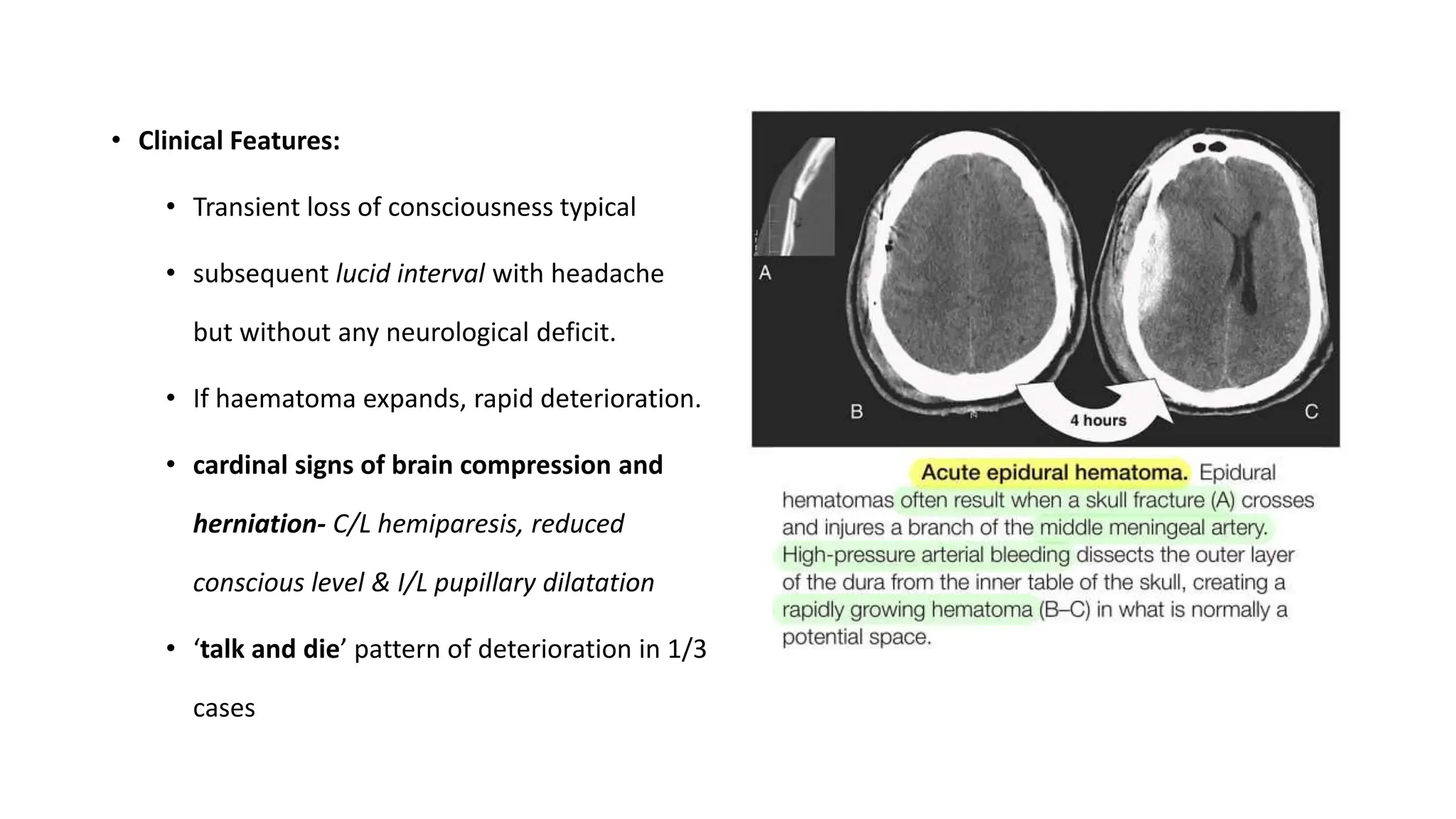 ACUTE TRAUMATIC BRAIN INJURY - PRESENTATION AND MANAGEMENT | PPTX ...