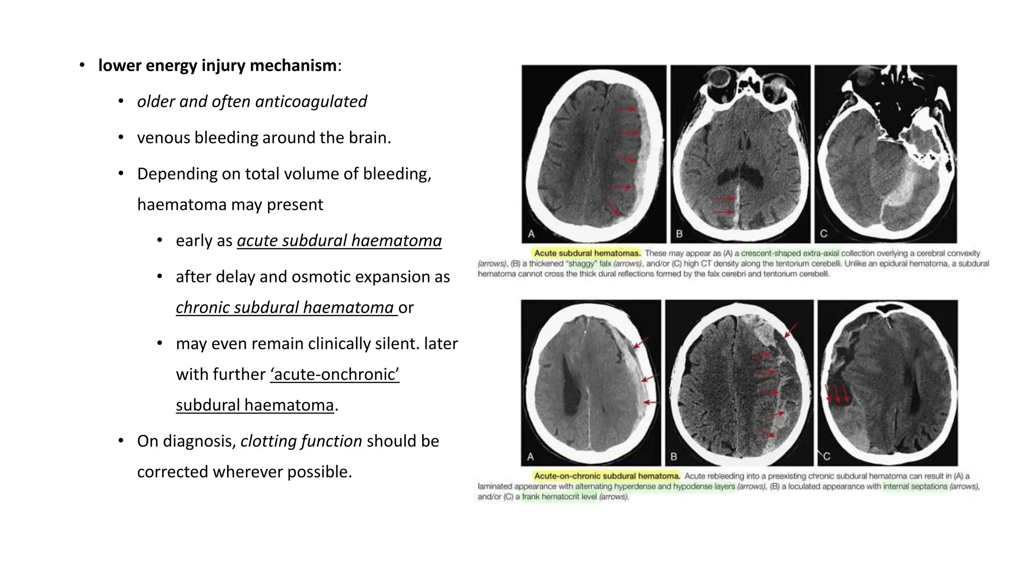 ACUTE TRAUMATIC BRAIN INJURY - PRESENTATION AND MANAGEMENT | PPTX ...