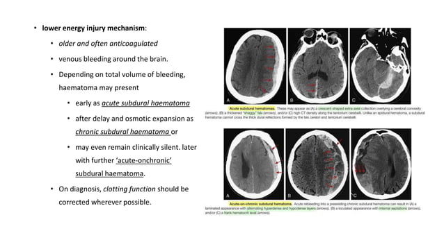 ACUTE TRAUMATIC BRAIN INJURY - PRESENTATION AND MANAGEMENT | PPTX ...