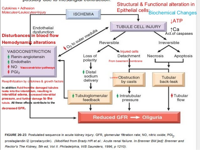 Acute tubular necrosis