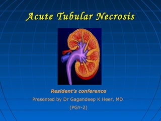 Acute tubular necrosis | PPT
