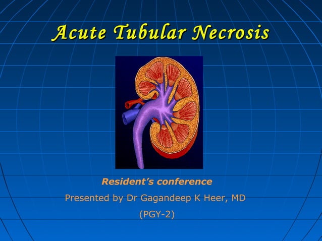 Acute tubular necrosis | PPT | Blood Disorders | Diseases and Conditions