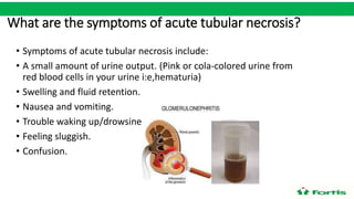 ACUTE TUBULAR NECROSIS.pptx