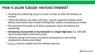 ACUTE TUBULAR NECROSIS.pptx