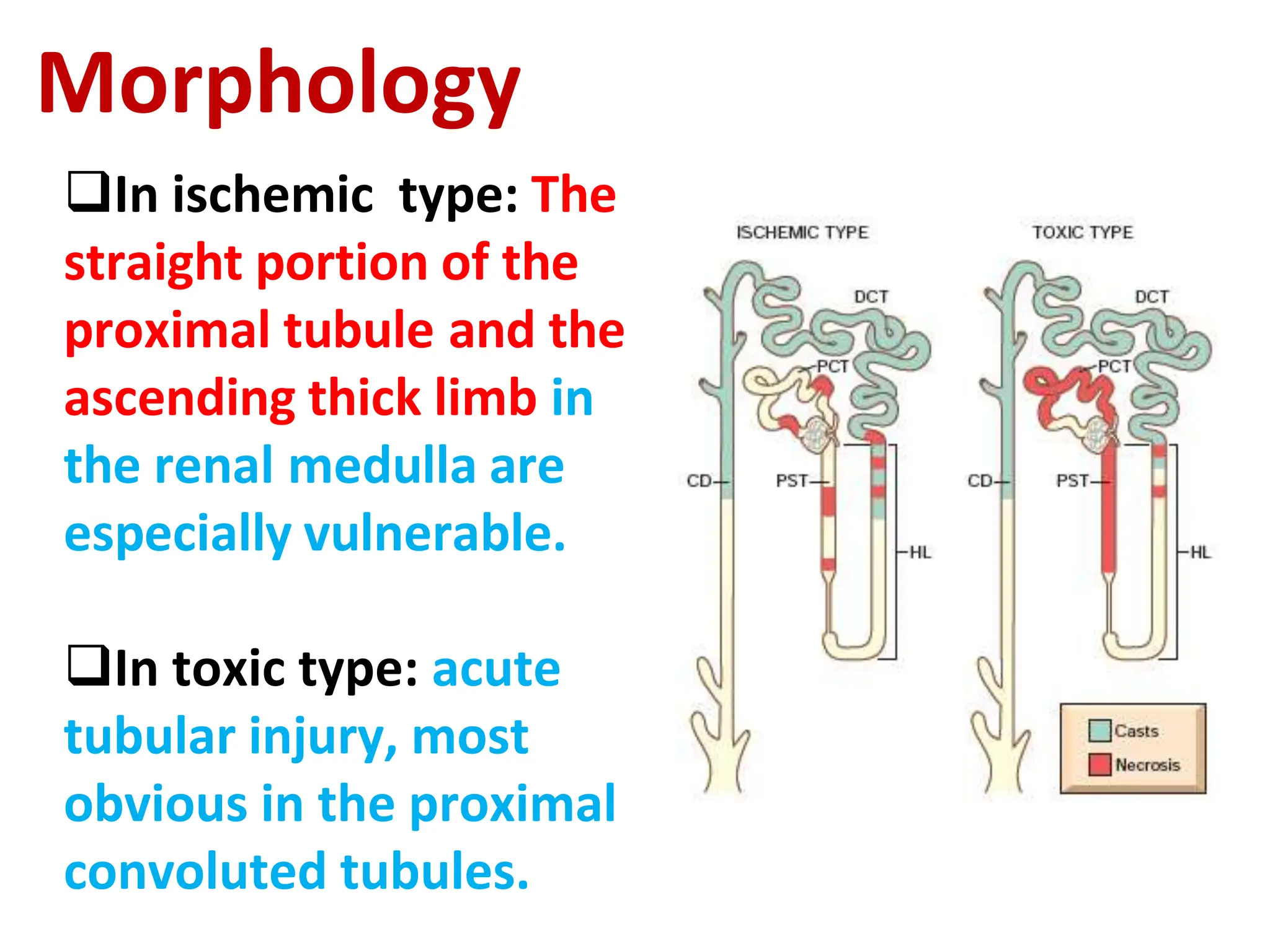 kidney pathology Acute tubular necrosis .pptx