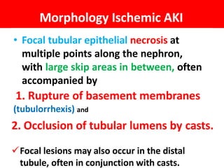 kidney pathology Acute tubular necrosis .pptx