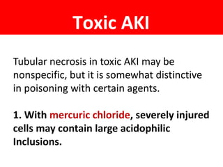 kidney pathology Acute tubular necrosis .pptx
