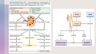 Acute Tubular Necrosis - Ischemic and Toxic ATN | PPTX