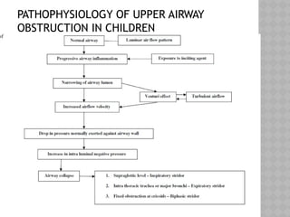 Acute upper airway obstruction is Blockage of any portion of the airway above the thoracic inlet ...