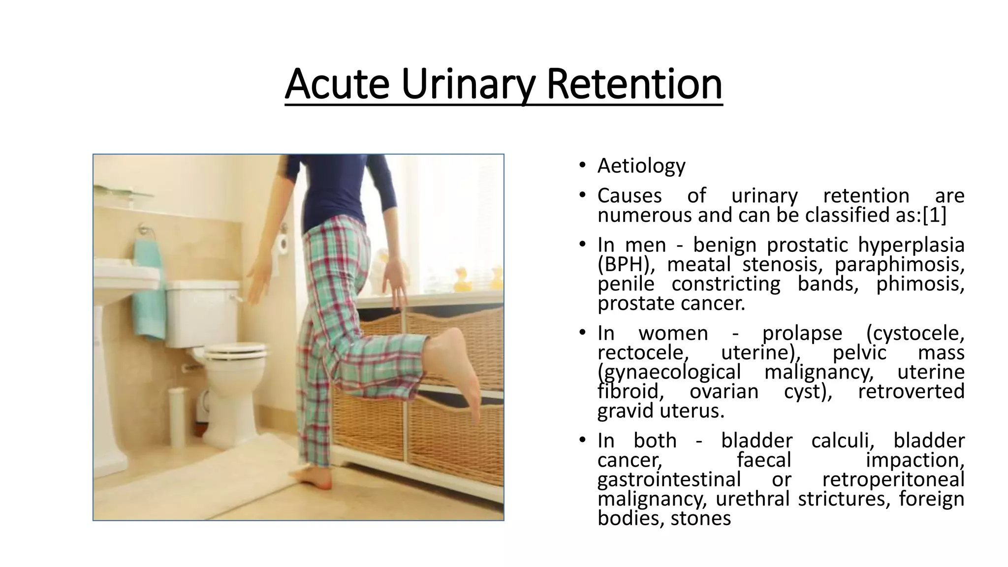 Acute urinary retention | PPTX