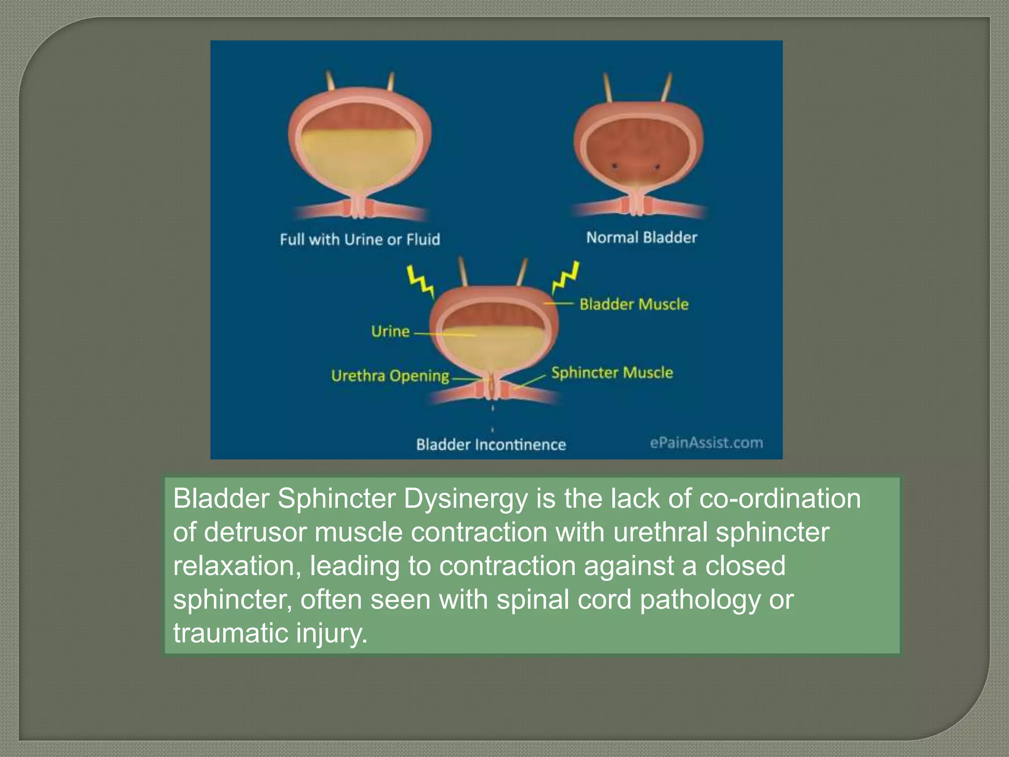 Acute Urinary Retention.pptx | Digestive Disorders | Diseases and ...