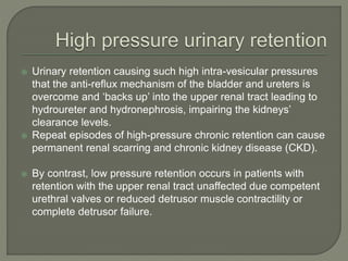 Acute Urinary Retention.pptx
