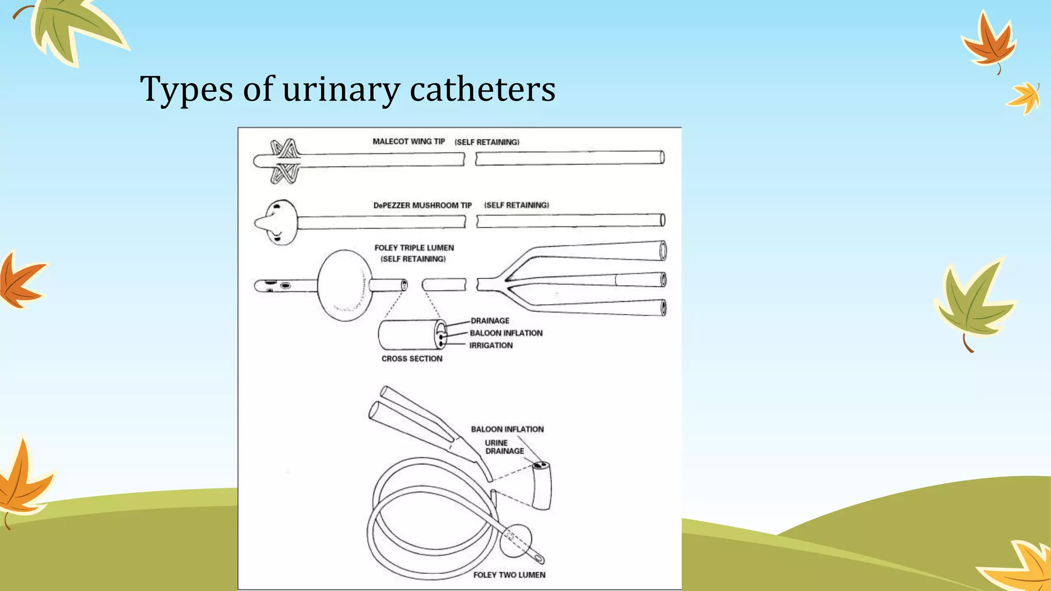 Urine Retention | PPTX