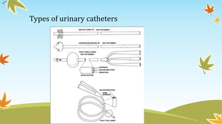 Urine Retention | PPTX