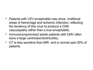 ACUTE VIRAL ENCEPHALITIS- clinical features and management | PPT