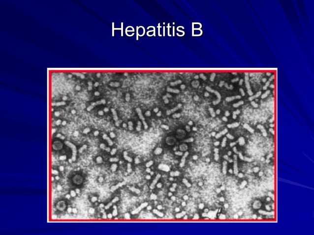 ACUTE VIRAL HEPATITIS.ppt
