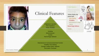acute liver failure in pediatrics final.pptx