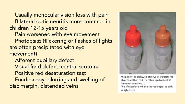 acute vision loss cme with case presentation 15022024 | PDF | Eye and ...
