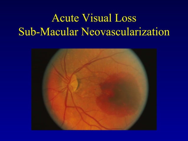 Acute visual loss | PDF