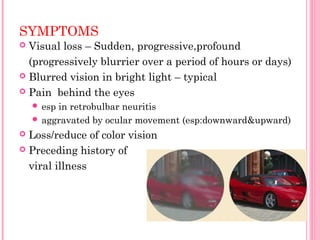 Acute Visual Loss | PPT