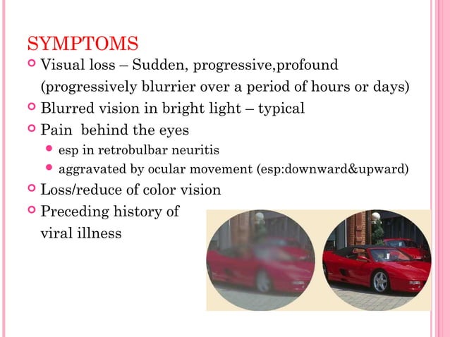 Acute Visual Loss | PPT | Eye and Vision Conditions | Diseases and ...