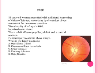 Acute Visual Loss | PPT